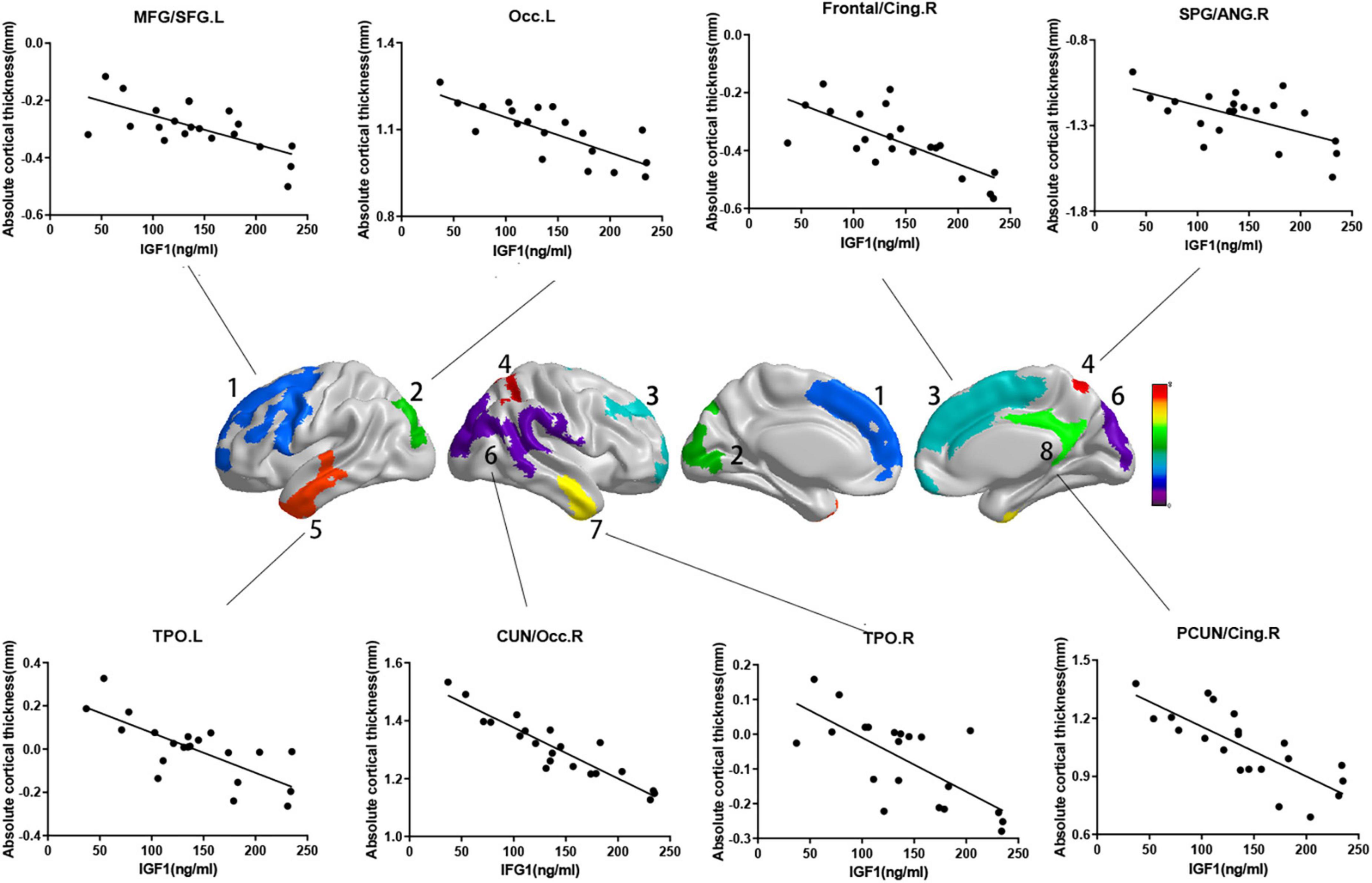 Frontiers | Alterations in brain structure and function associated with pediatric growth hormone ...